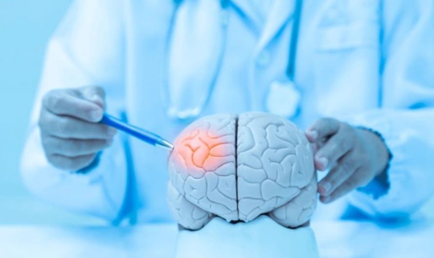 Mga Bagay na Dapat Ihanda Bago Magpa-Raspa (Dilation and Curettage o D ...